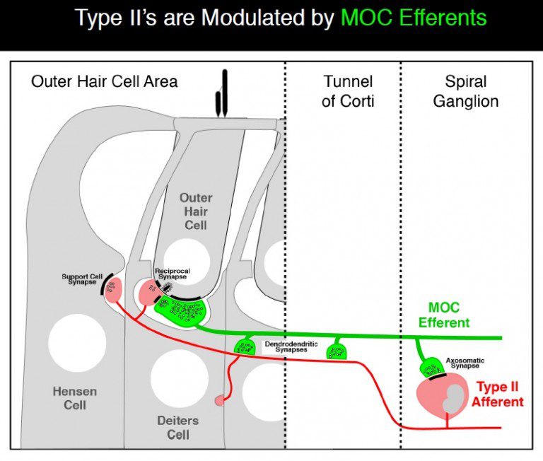 Auditory Nociception and Pain Hyperacusis Symposium - Hyperacusis Research