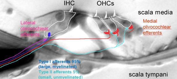 2017 ARO Event – Next Steps for Hyperacusis - Hyperacusis Research