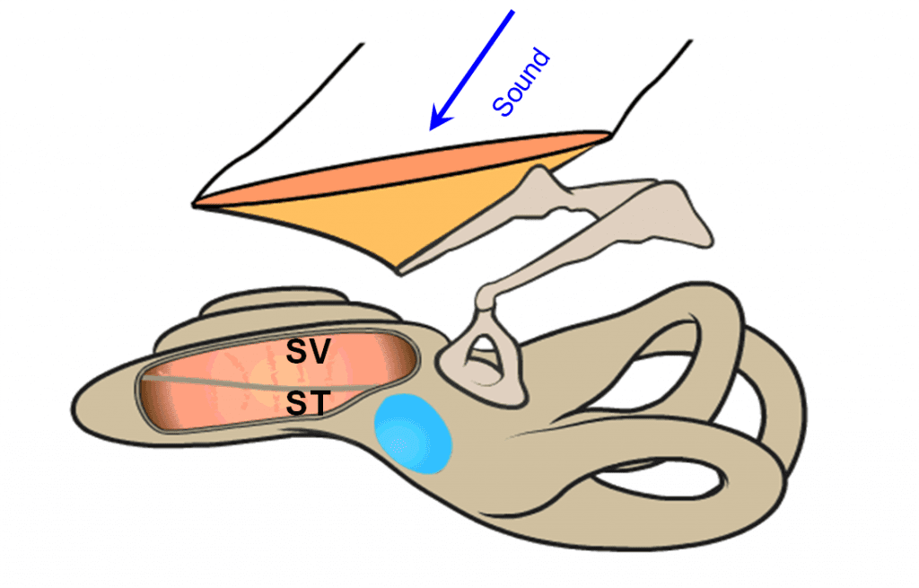 2017 ARO Event – Next Steps for Hyperacusis - Hyperacusis Research